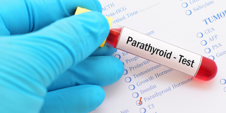 Lista de boli endocrine. Afectiuni de natura endocrina