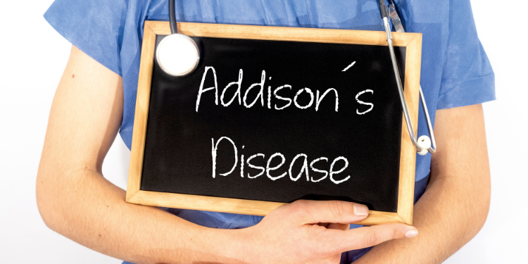 Ce este boala Addison? Cauze, simptome, gestionare pe termen lung