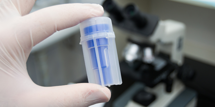 Ce rol are coprocultura si cand se recomanda examenul coproparazitologic?